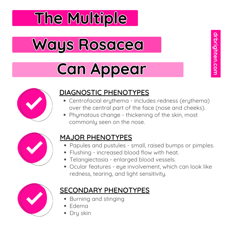 What Causes Rosacea on Face: Treating Rosacea Naturally