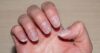 What Your Fingernails Say About Your Health