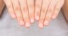 What Your Fingernails Say About Your Health