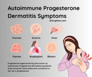 Autoimmune Progesterone Dermatitis: Causes & Foods to Avoid