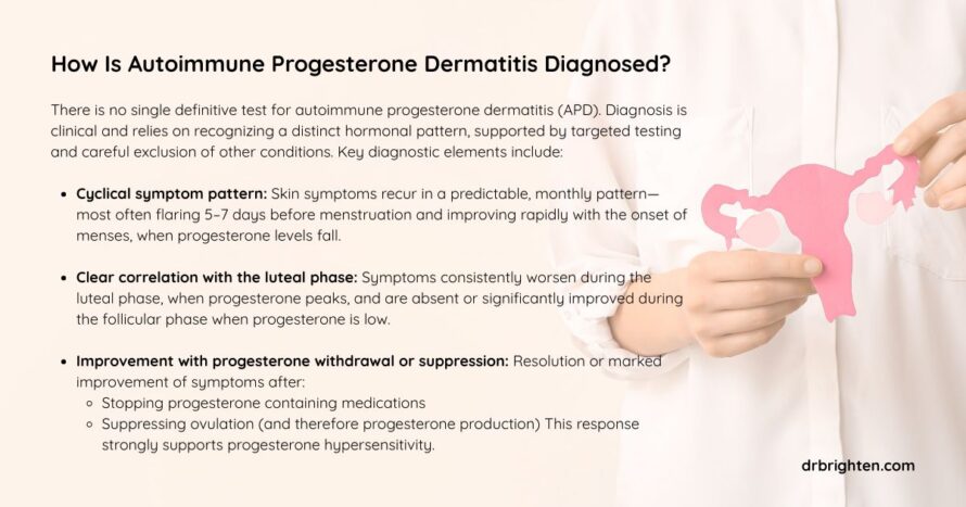 Autoimmune Progesterone Dermatitis: Causes & Foods to Avoid